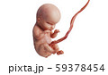 Embryo human fetus unborn, side view - Stock Illustration [59378372 ...